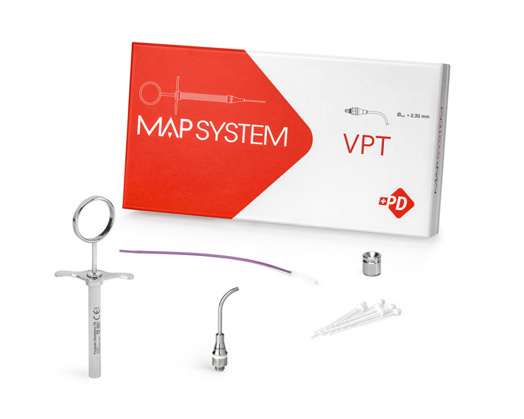 MAP System® - by PD Dental® | Restoration products