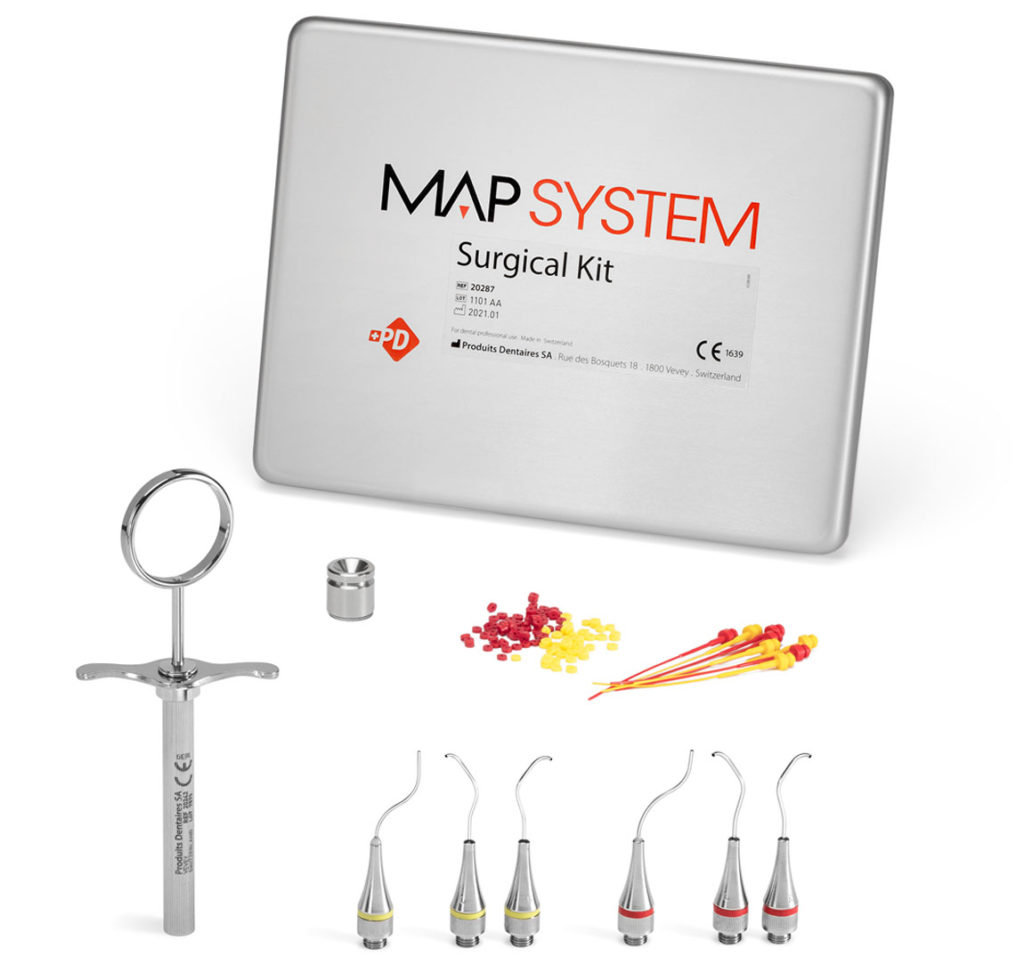 MAP System® - by PD Dental® | Restoration products